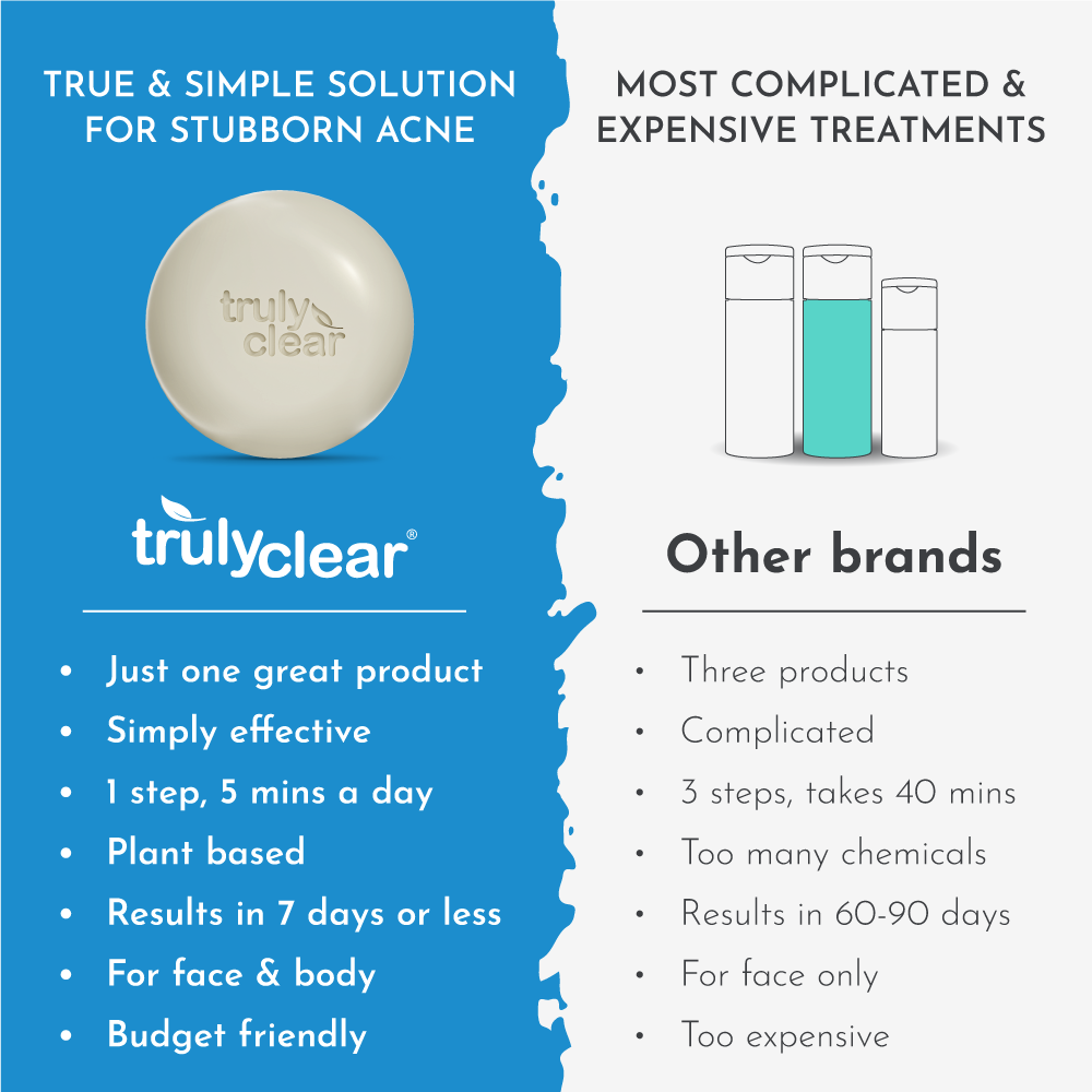 Truly Clear Acne Bar - 1-Step Cleanser for Breakout-Prone Skin
